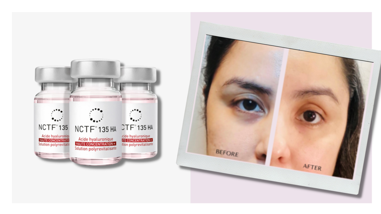 Before and After: See How NCTF Takes Years Off Your Face - Bella Pelle